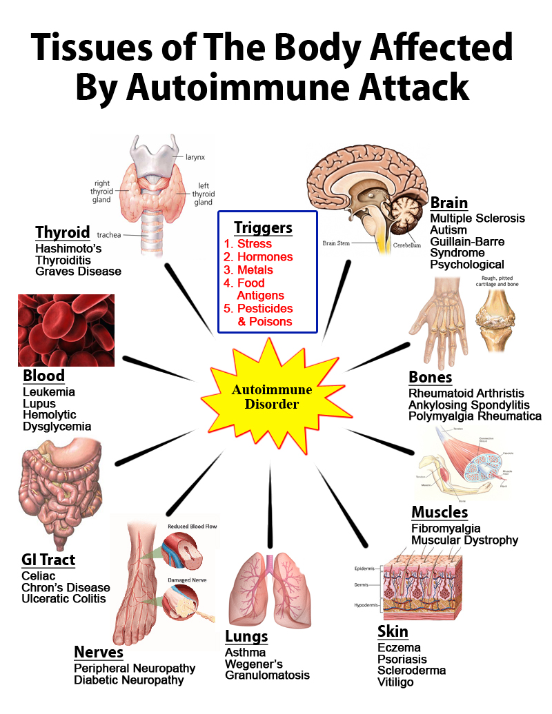 Terry Willard – Are Autoimmune Diseases (AI) a Coup Attempt Reflecting ...